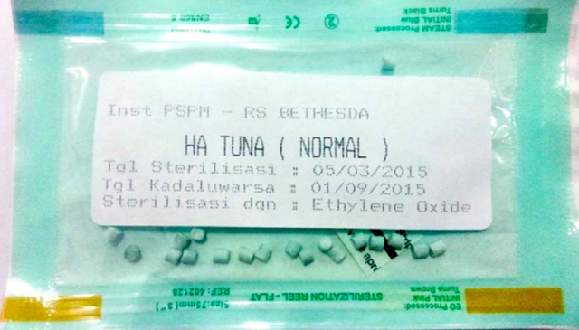 Wow! Tulang Ikan Ini Bisa jadi Obat dan Keripik